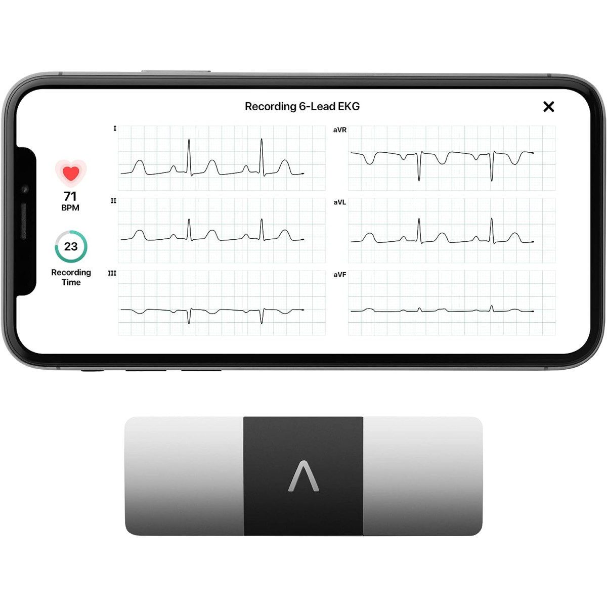 Kardia Mobile 6L enregistreur ECG 6 dérivations sans fil Alivecor©, 2024,