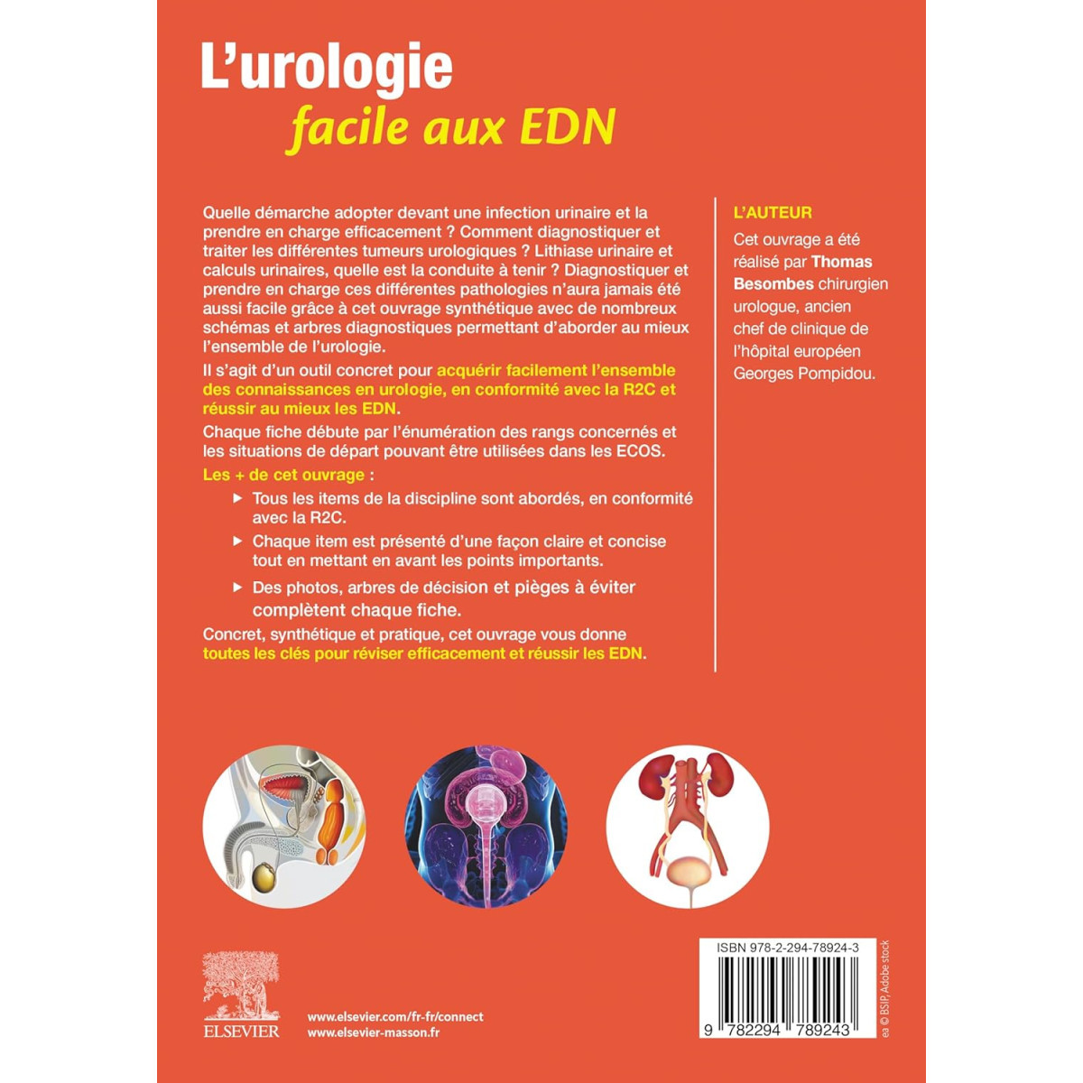 L'Urologie facile aux EDN - Fiches de synthèse illustrées, 2025, Thomas Besombes, Elsevier Masson